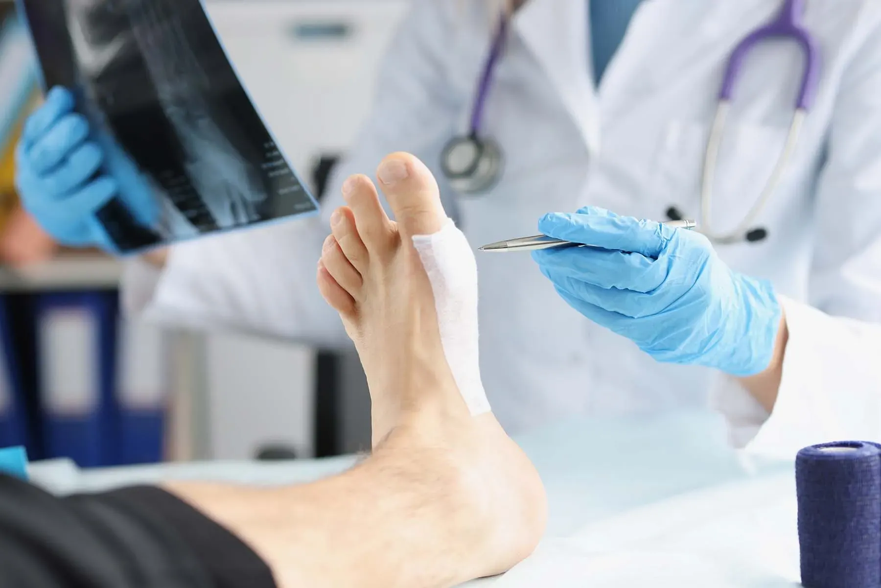 Cracked Heels Archives - European Foot & Ankle Clinic