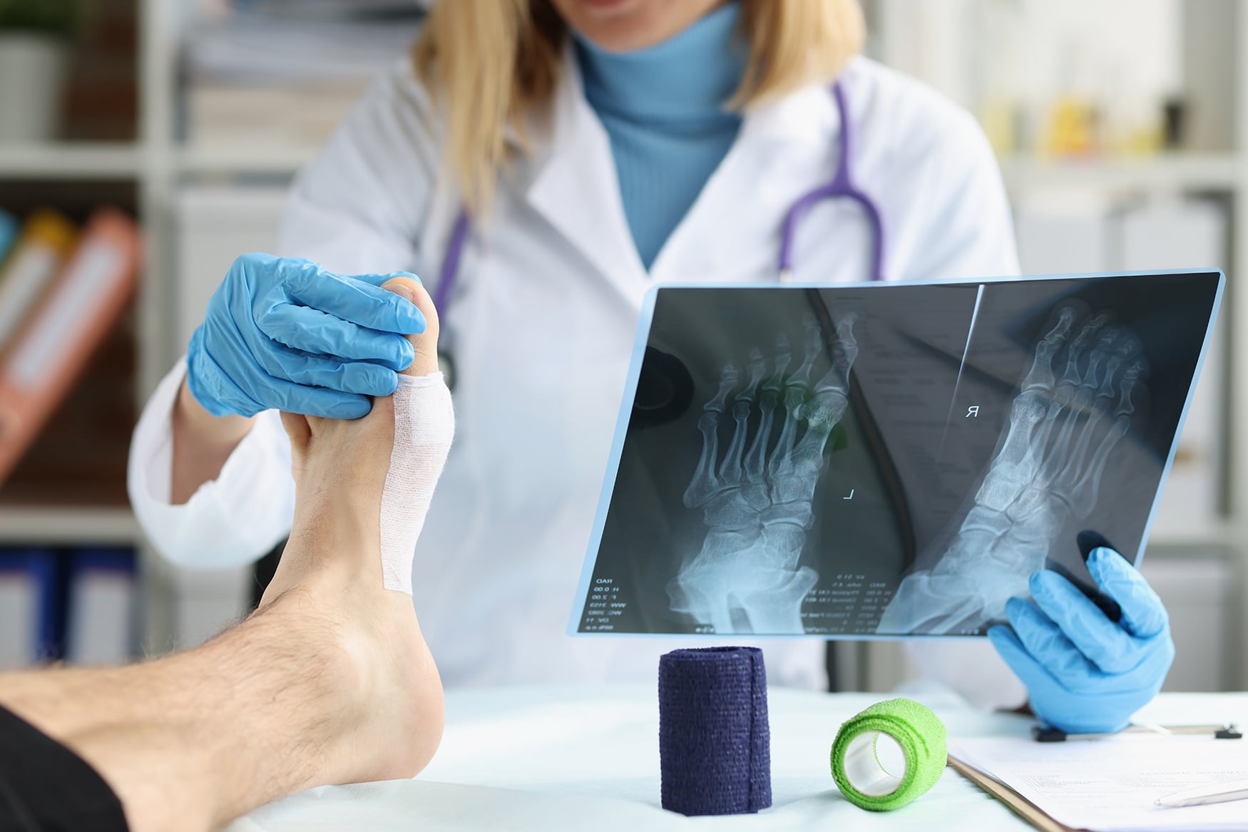 X-Rays - European Foot & Ankle Clinic